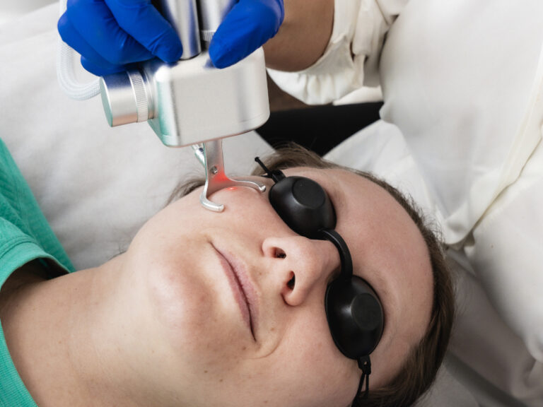 Traitement laser au visage : raffermir, rajeunir, pores dilatés